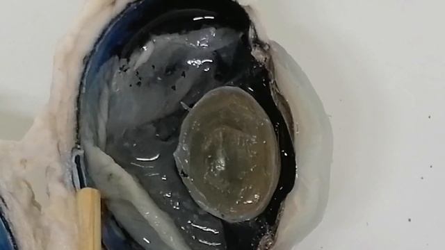 Орган зрения. Строение глазного яблока, его оболочки