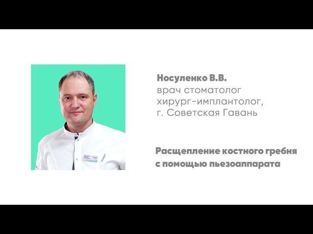 Расщепление альвеолярного гребня при помощи пьезоаппарата Sonic Surgeon 600L, Южная Корея.