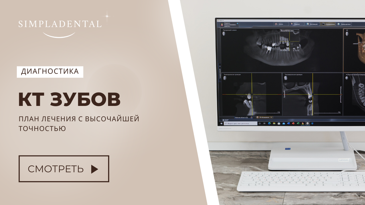 Для чего делать компьютерную томографию?