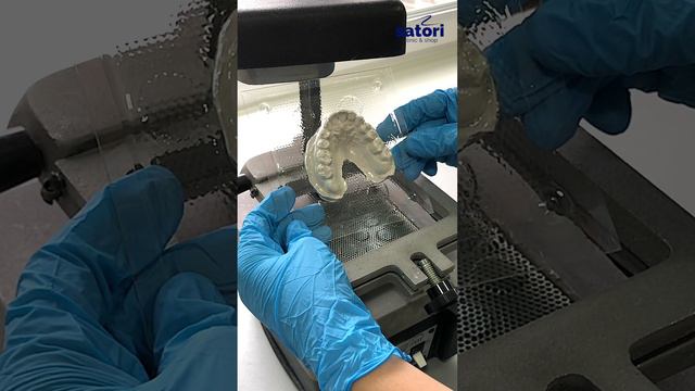 Ретенционная каппа после снятия брекетов