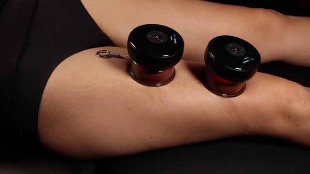 Массаж бёдер (четырехглавая мышца). Динамические вакуумные банки AchedAway Cuppers.