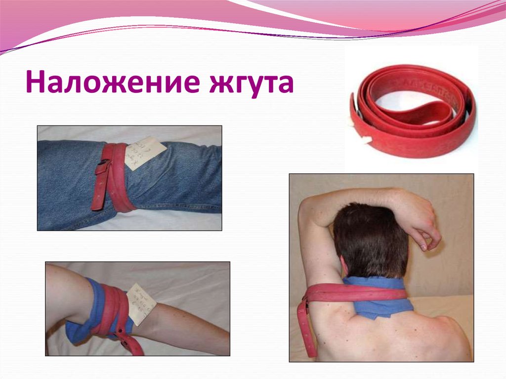 Остановка кровотечений и развенчание некоторых мифов об этом