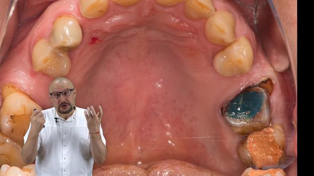 Как вам такой интересный случай?