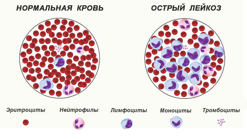 Сказки для взрослых: детский лейкоз(продолжение)