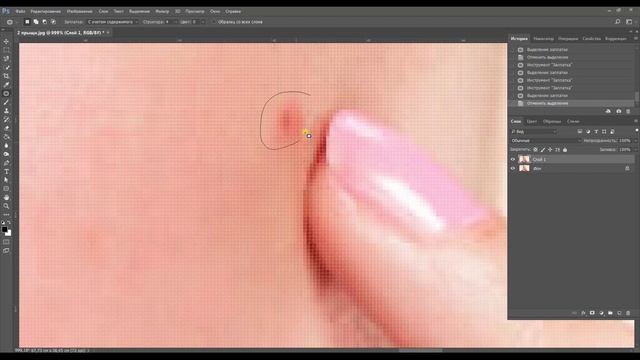 Удаление дефектов