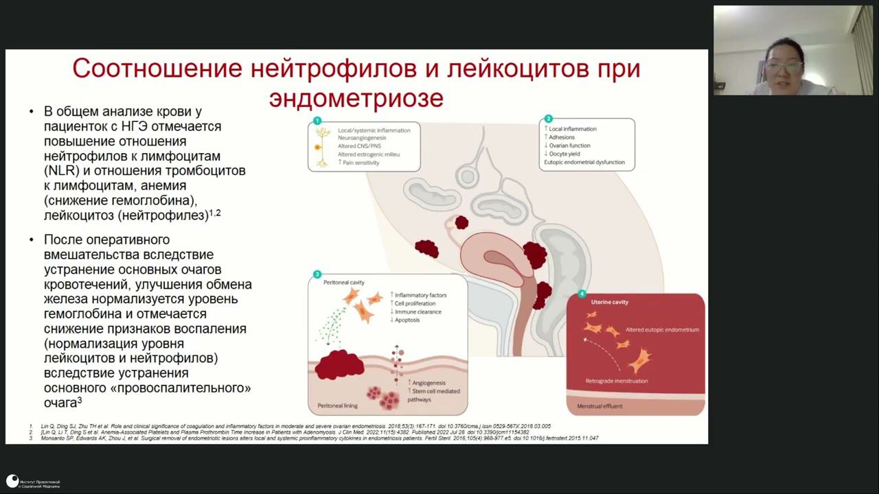 Клиническое значение сывороточных биомаркеров в лечении наружной формы генитального эндометриоза