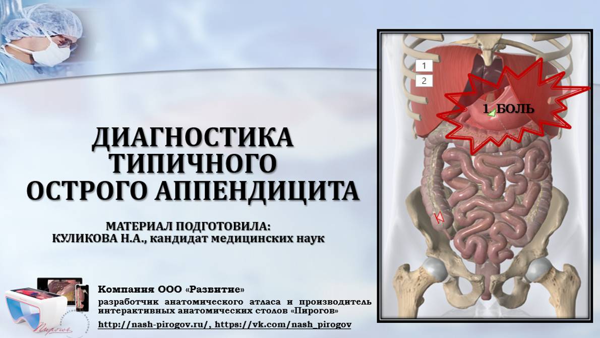 ОБЗОР ЛИТЕРАТУРЫ - Диагностика типичного острого аппендицита