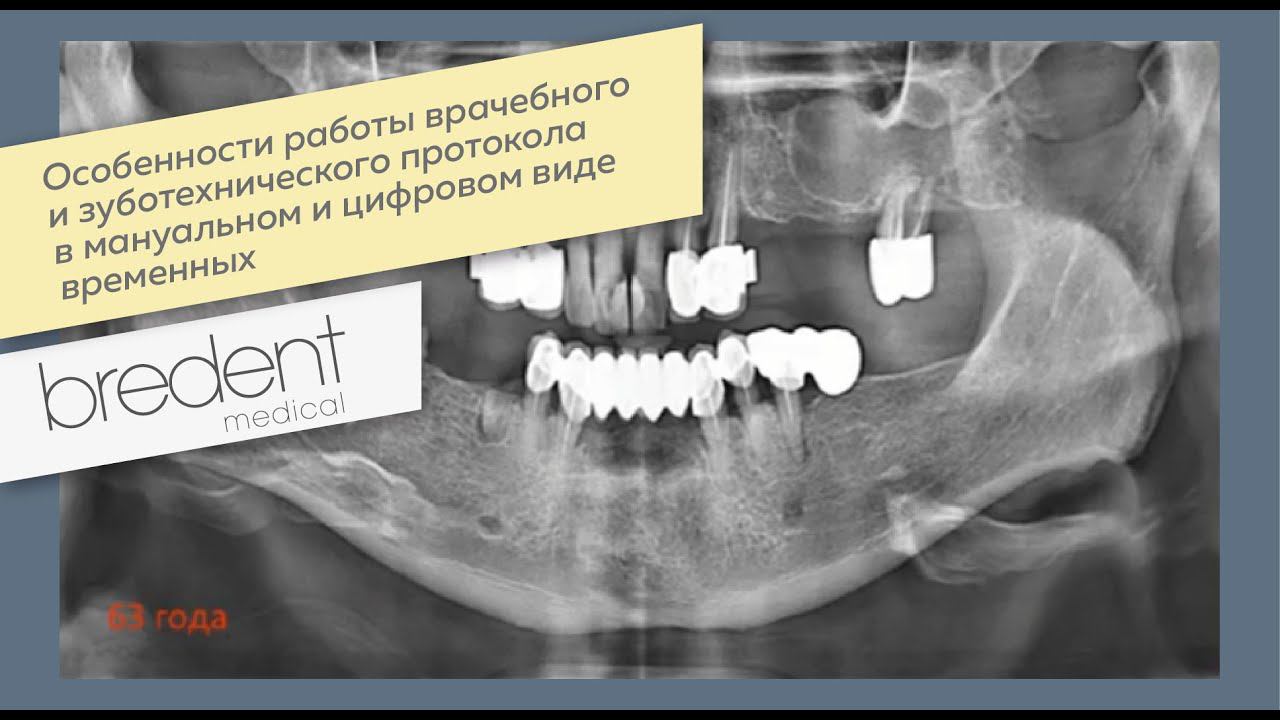 Особенности работы врачебного и зуботехнического протокола  в мануальном и  цифровом виде временных