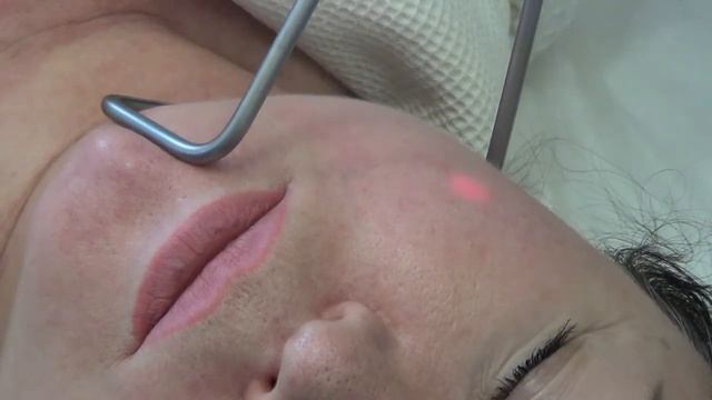 Сканер L-Runner