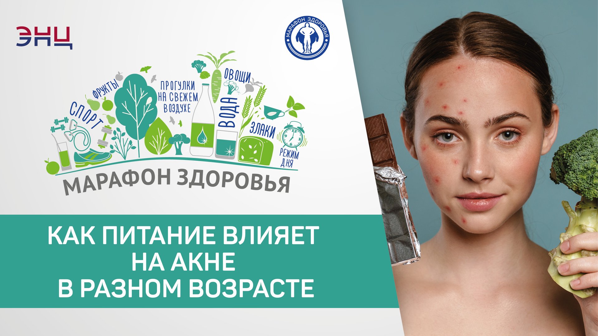 Акне и питание: подбираем рацион и лечим кожу