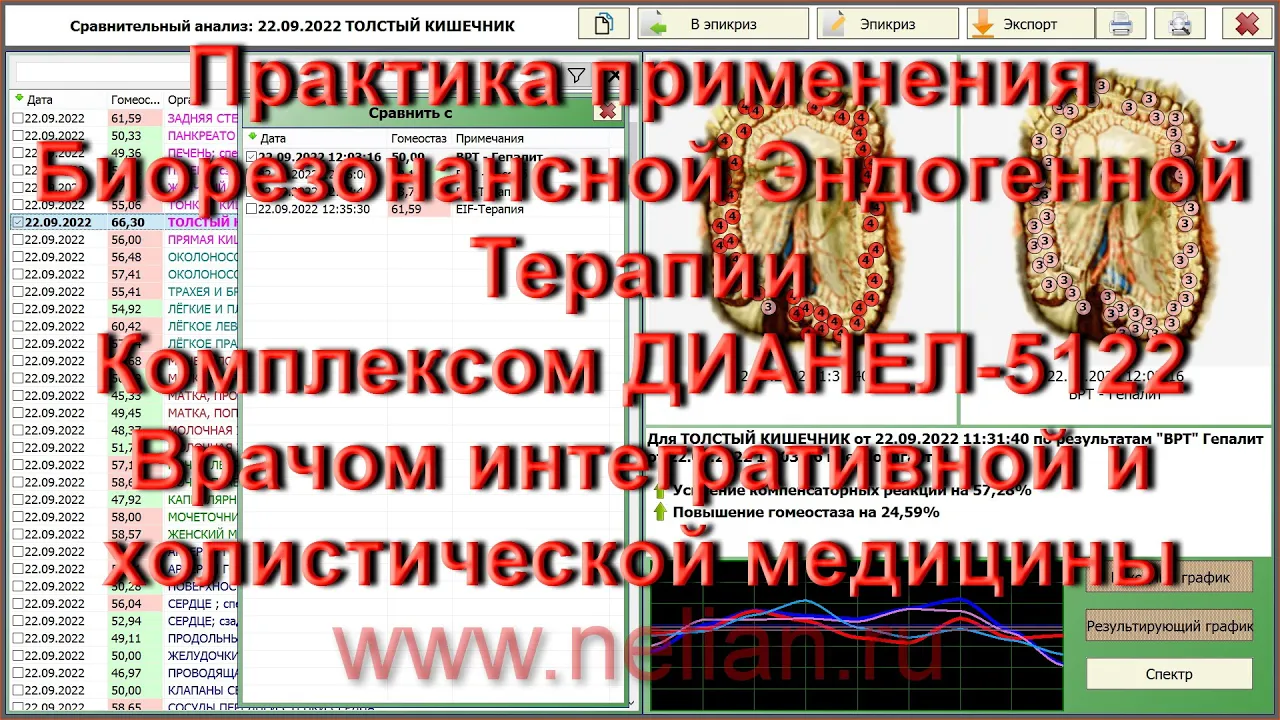 Эндогенная терапия Комплексом ДИАНЕЛ-5122 в практике врача интегративной медицины,клинический пример