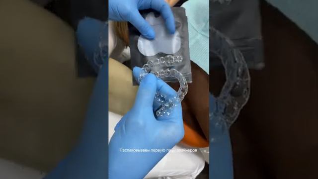 Процесс фиксации элайнеров