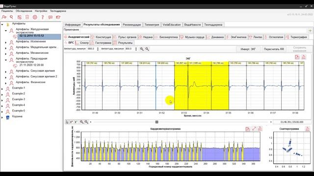 Урок 8. Редактирование артефактов