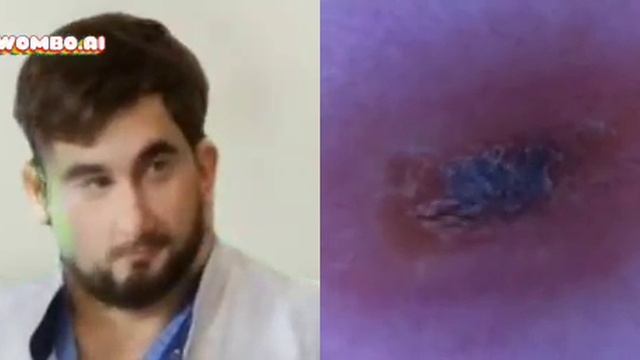 Дуэт с базалиомой