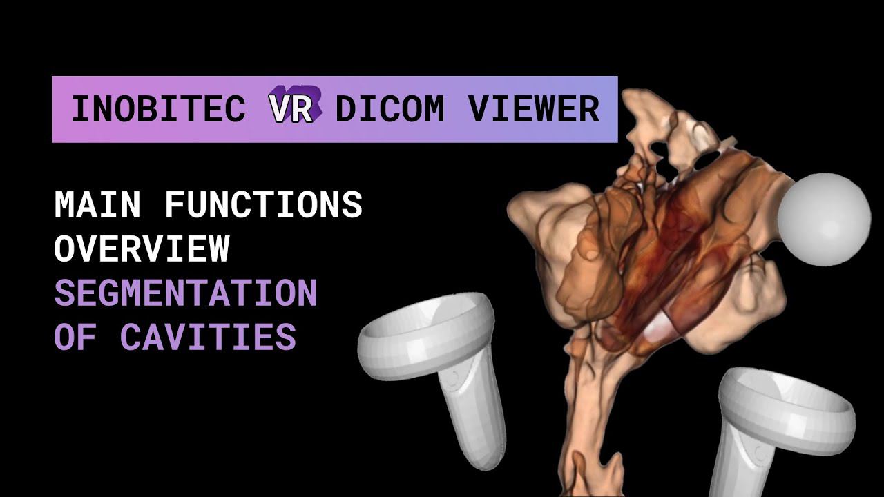 Обзор функциональности программы Inobitec VR DICOM Viewer. Сегментация полостей.