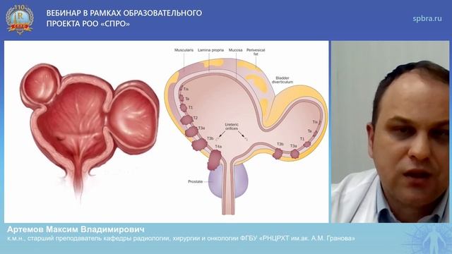 Вебинар "Рак мочевого пузыря: от диагностики к лечению"