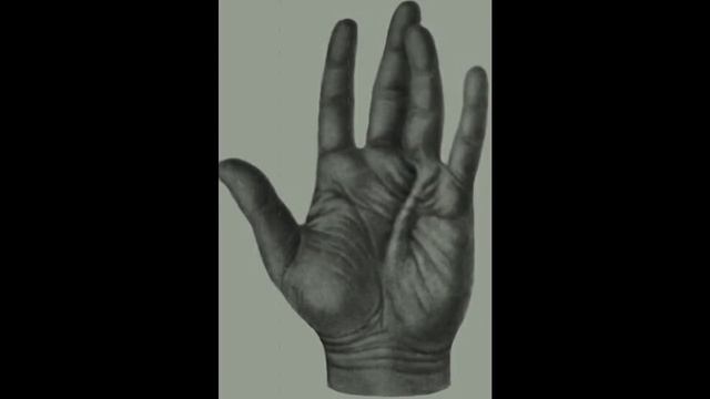 SCP-610 _ _Ненавидящая Плоть.