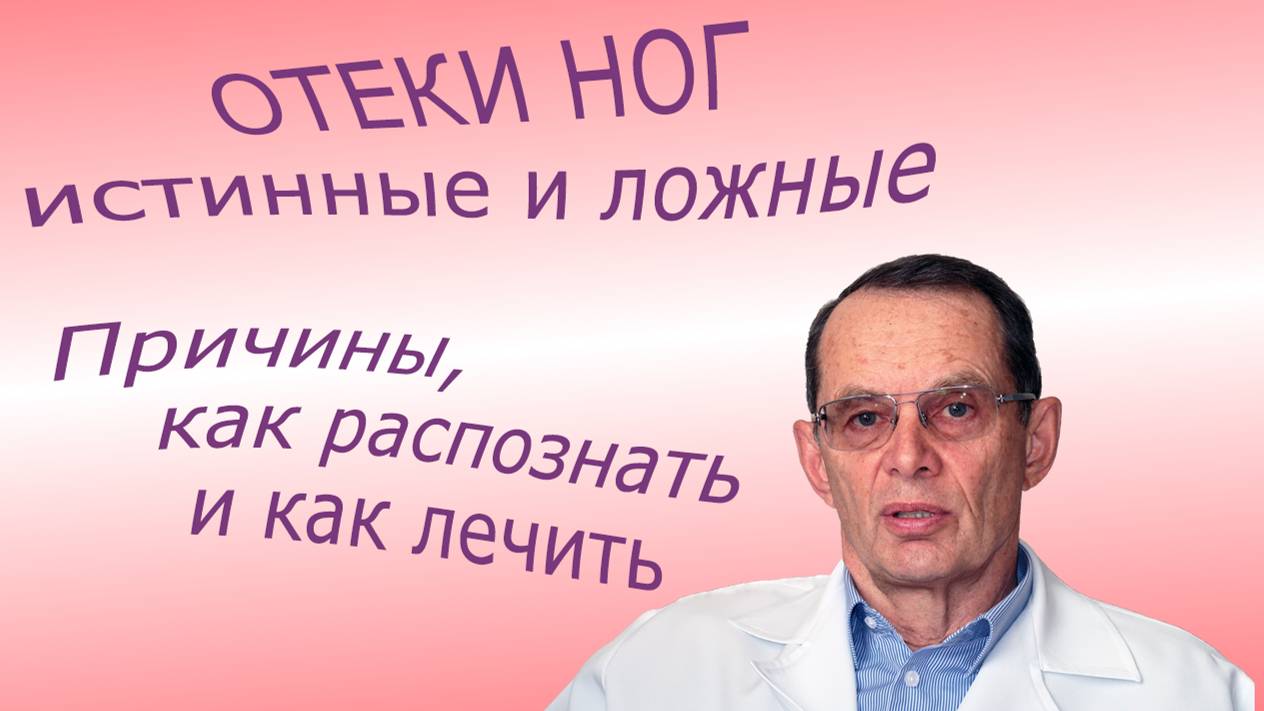 Отек ног истинный и ложный. Почему, как распознать и как лечить. Видеобеседа для ВСЕХ и для врачей.