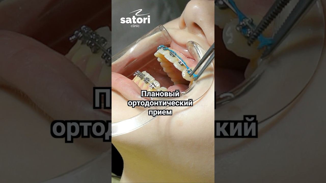 Плановый прием врача-ортодонта