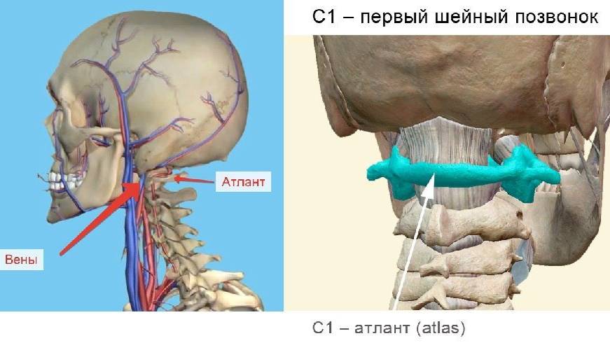 Атлант и панические атаки!