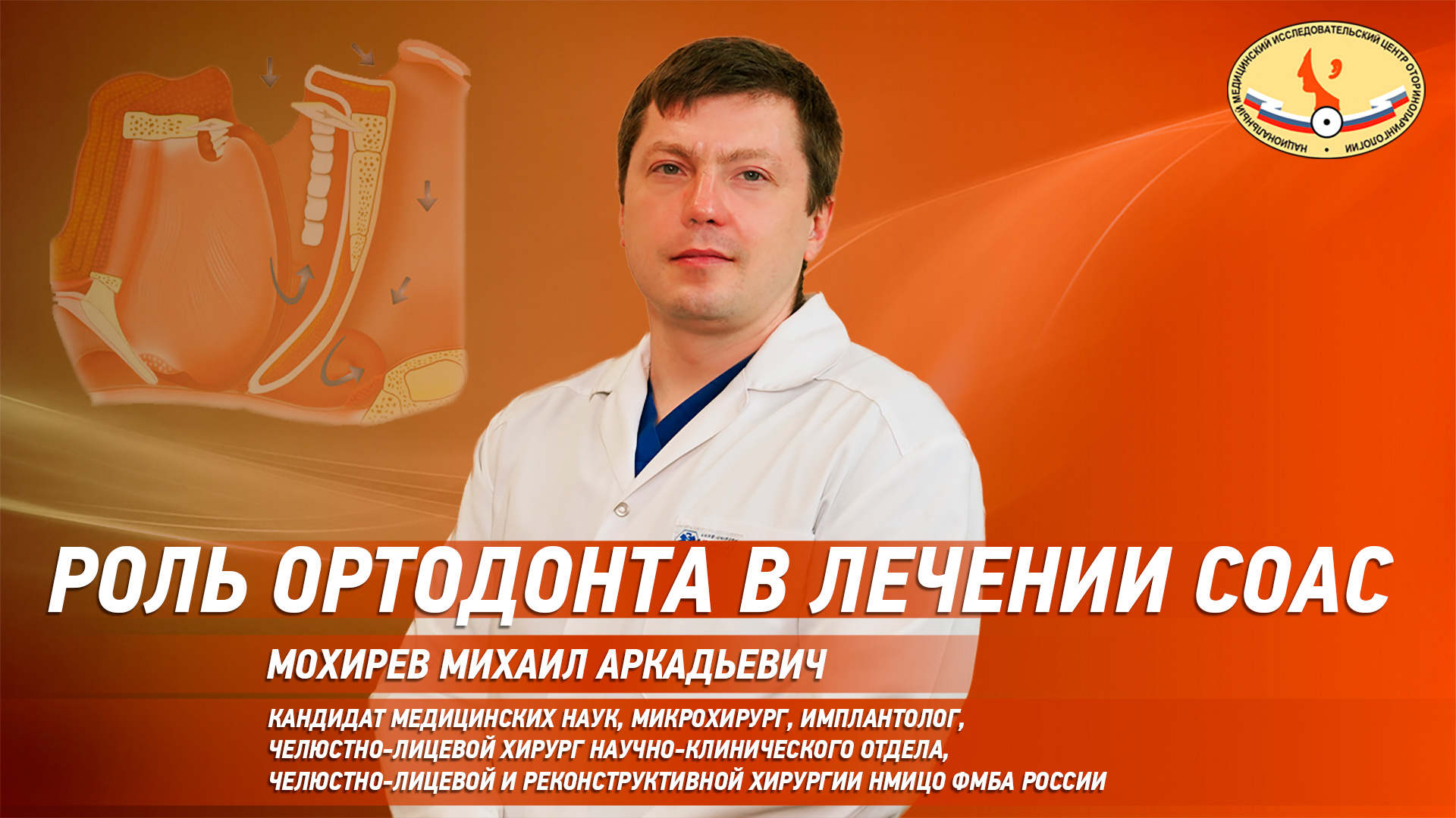 Роль ортодонта в лечении СОАС.