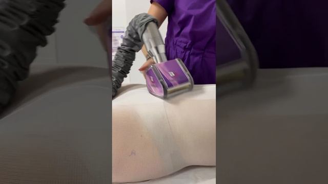 ПОДТЯГИВАЕМ ТЕЛО БЕЗ ЗАБОТ. Как проходит процедура LPG массажа? Студия WOWBODY.