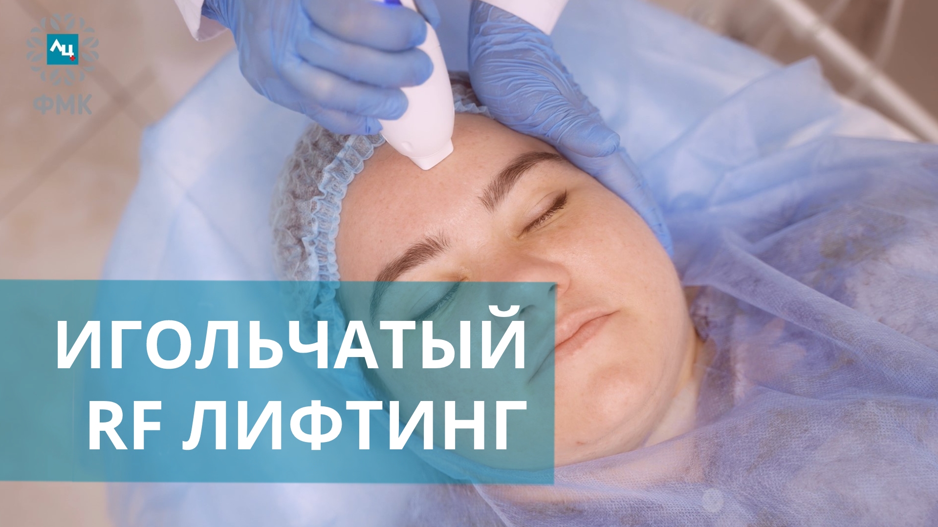 ? Игольчатый RF-лифтинг для коррекции возрастных изменений кожи лица. Игольчатый RF-лифтинг лица.