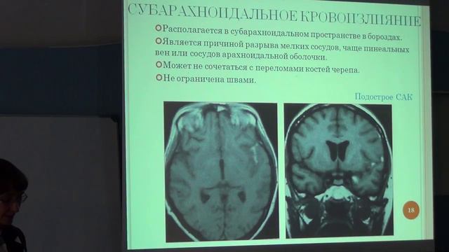 МРТ в оценке состояния мозговых оболочек