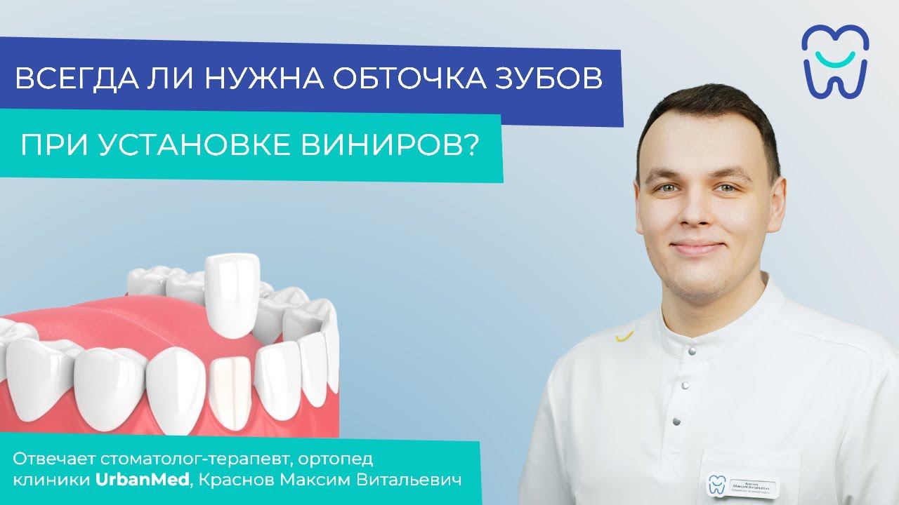 Всегда ли нужна обточка зубов при установке виниров?