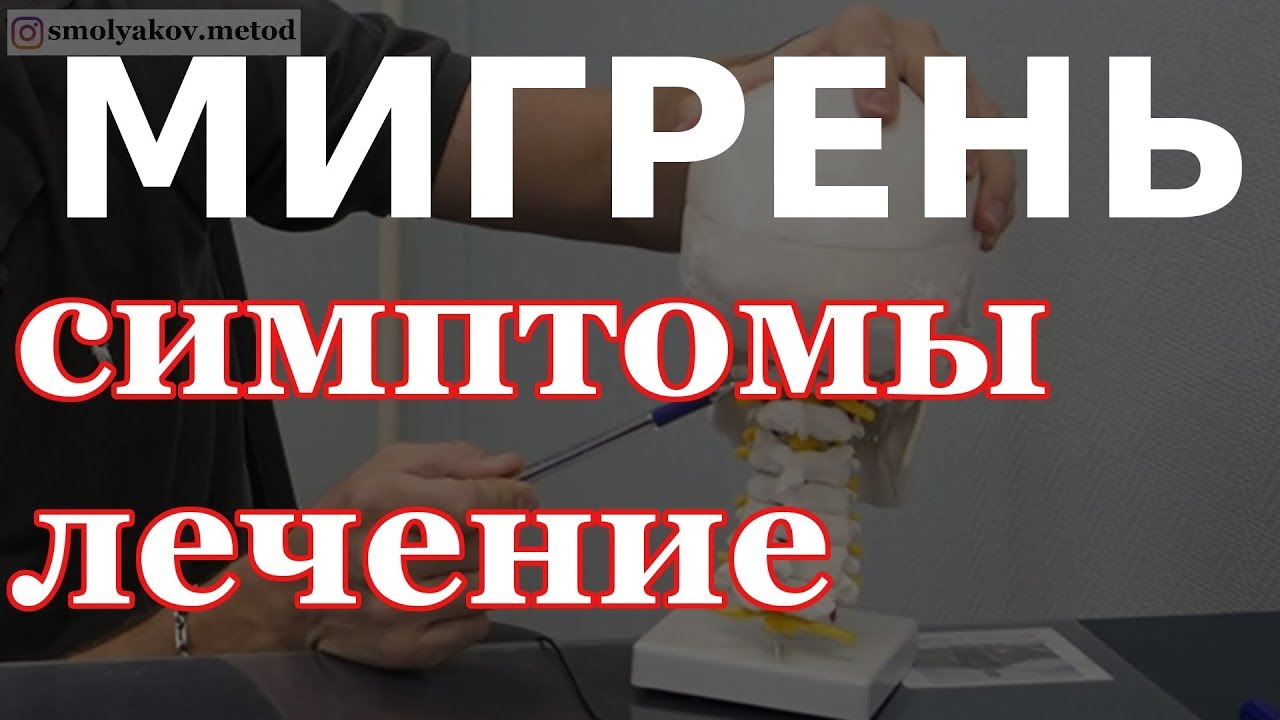 Мигрень, что делать. Как лечить головную боль в домашних условиях