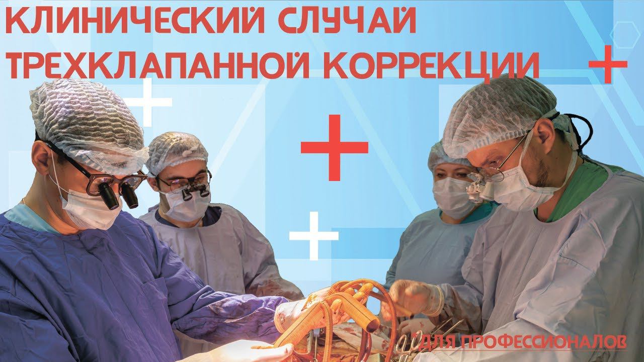 Трехклапанная коррекция у пациентки с сердечной недостаточностью (для профессионалов)
