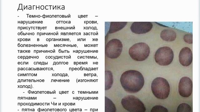 Вакуум терапия