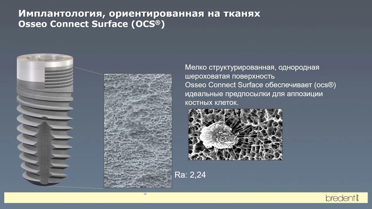 Одномоментная терапия с использованием современных бионических материалов