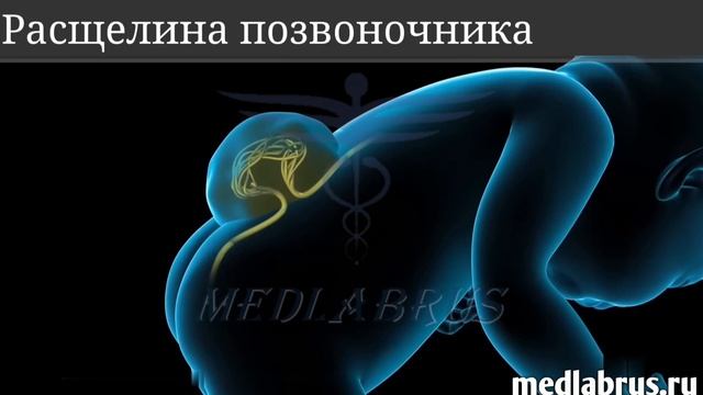 Фолиевая кислота во время беременности: важность, дозировка и рекомендации