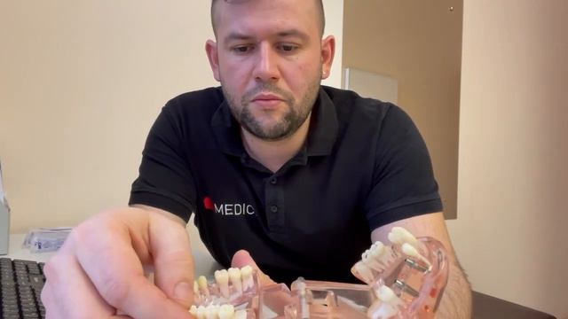 Типы зубных протезов Недостатки и преимущества Объясняю на пальцах