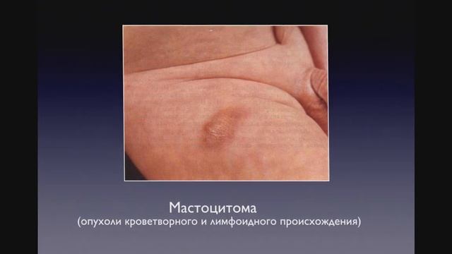 Новообразования кожи в практике косметолога