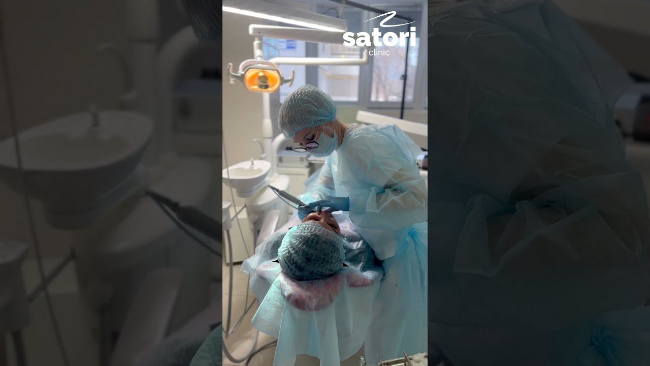 Имплантация зубов  #стоматология #зубы #имплантациязубов