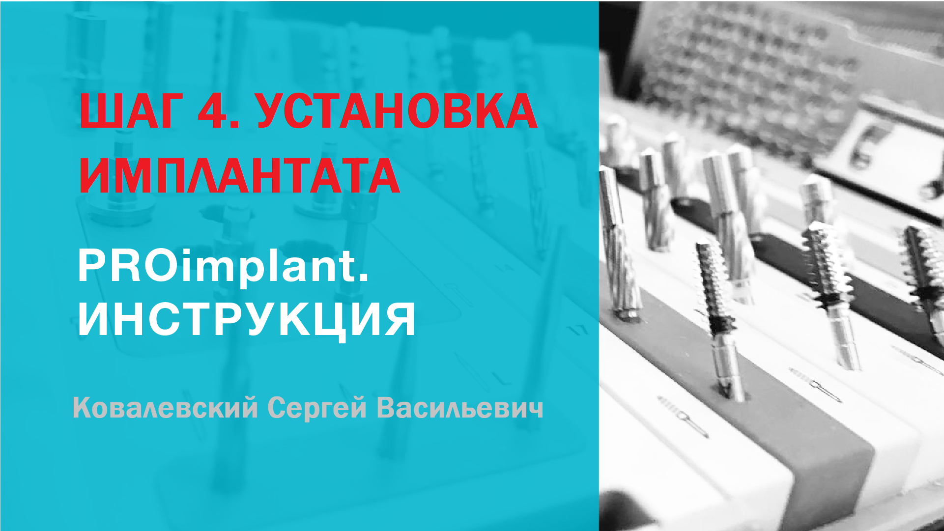 Дентальная имплантация для начинающих. Шаг 4. Установка имплантата ANKYLOS.