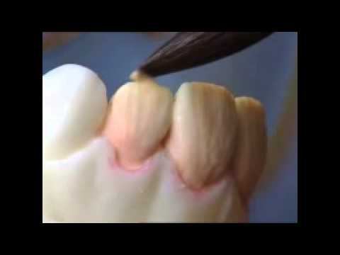 HeraCeramZirkonia -работа с компонентами Matrix