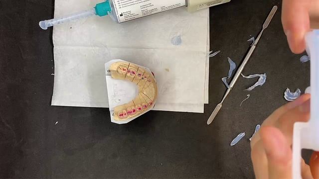 Memosil 2 - изготовление временных композитных