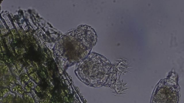 Стая хищных коловраток (на кусочке листа)