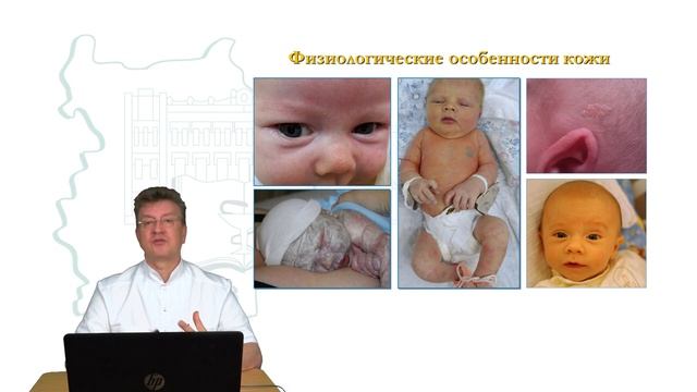 Физиологические пограничные состояния кожи у новорождённого (1)
