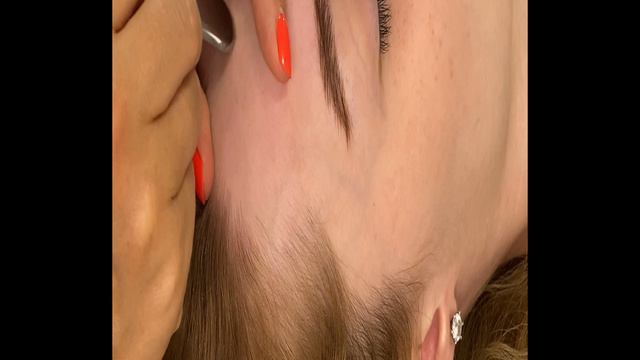 Зона лба. Морщины. Массаж лица. Инструментальный массаж NordBlade. Специалист: Вера Соболевская.