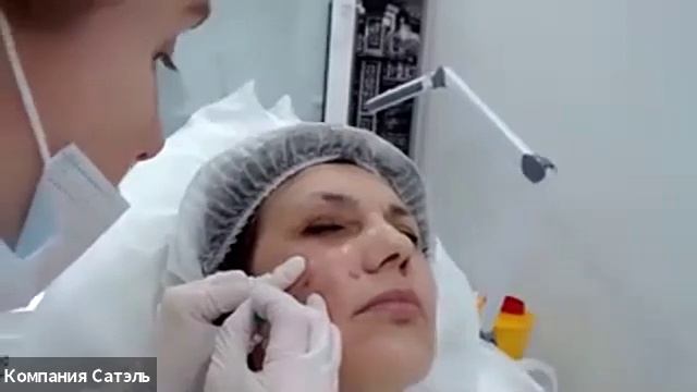 Демонстрация плазмолифтинга