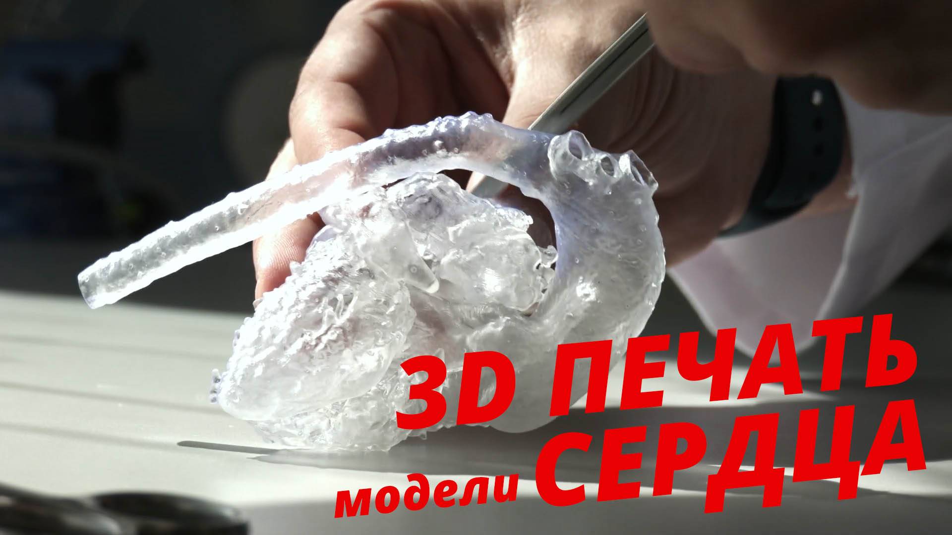 Технологии 3D-принтинга все активнее применяются в моделировании кардиохирургических вмешательств.