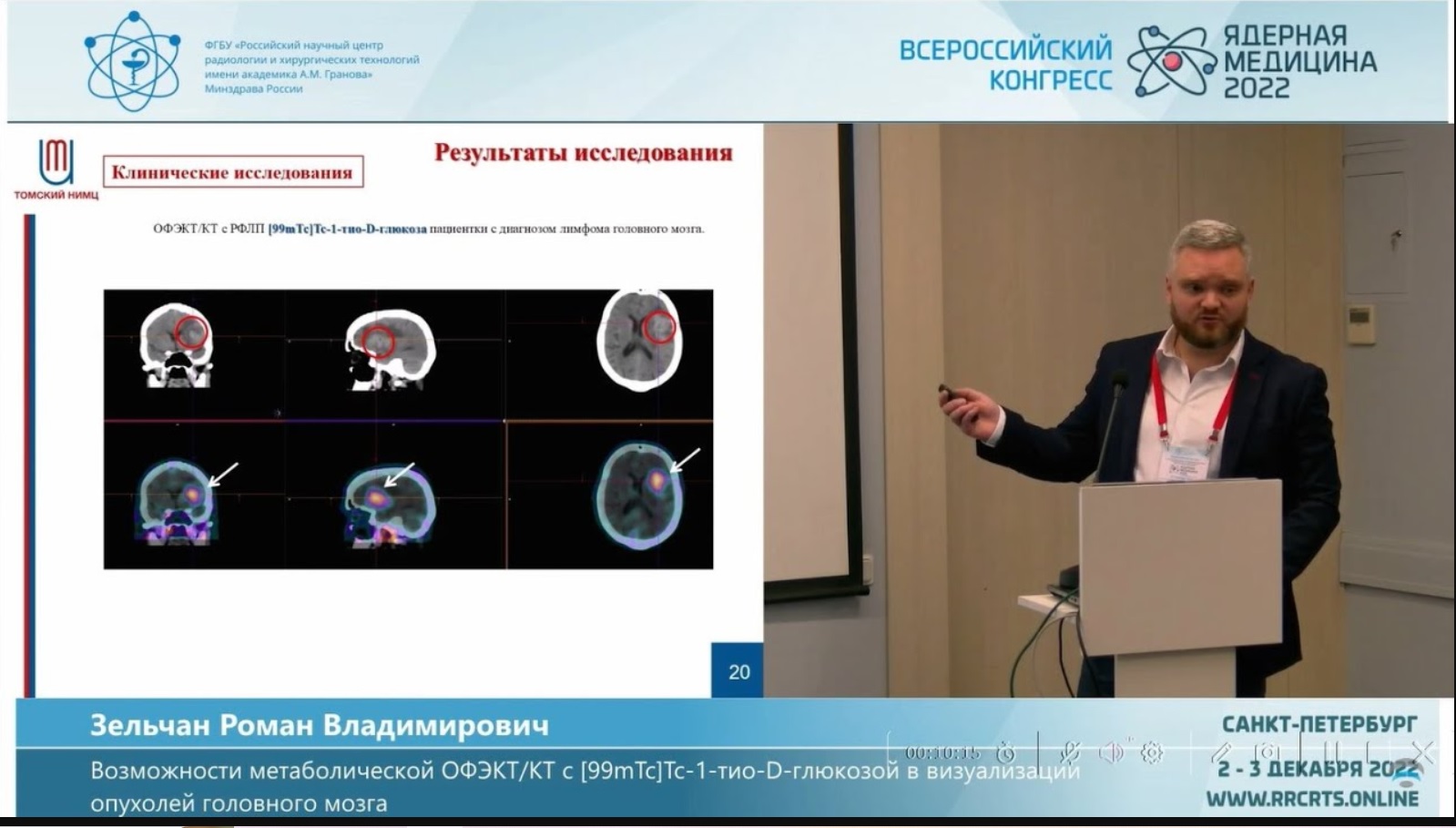 Возможности метаболической ОФЭКТ/КТ с Тиоскан, 99mTc  в визуализации опухолей головного мозга