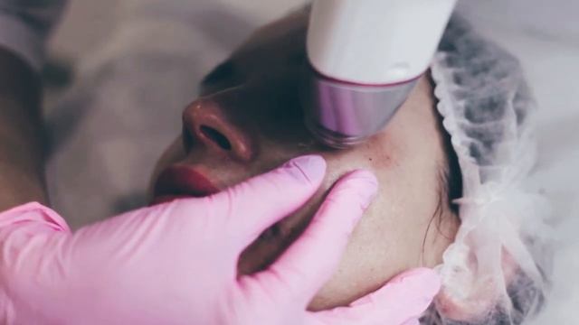 Микроигольчатый RF-лифтинг INFINI Сеть клиник косметологии GEN87