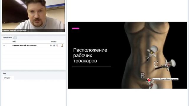 Острый аппендицит  Лечение.mp4