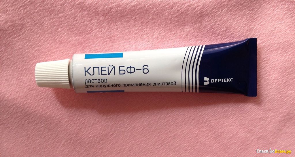 ВЫ ПОРЕЗАЛИСЬ И НЕ ЗНАЕТЕ ЧТО ДЕЛАТЬ? . СЛУЧАЙ ИЗ ЖИЗНИ. ВСЕМ СРОЧНО СМОТРЕТЬ!!!.