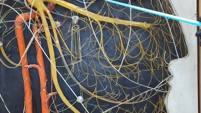 Тройничный нерв